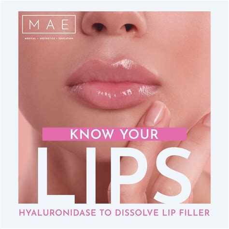Understanding Hyaluronidase How To Dissolve Lip Filler Medical