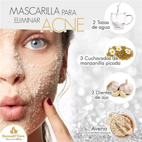 Mascarilla Casera para el Acné Los ingredientes que necesitamos so