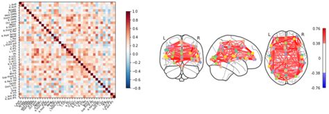 gnns in neuroscience graph convolutional networks for fmri analysis by sidney hough