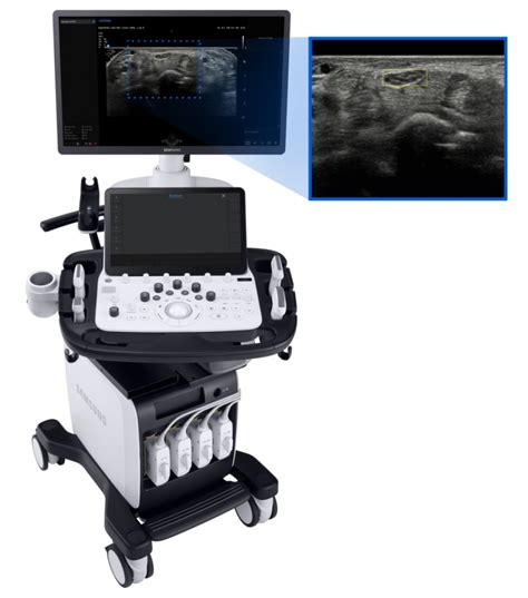 Key Differences Between Ultrasound And Ct Scans Deep Medical Centre