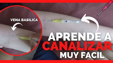 Como CANALIZAR UNA VENA En El BRAZO En 1 MINUTO VENOCLISIS