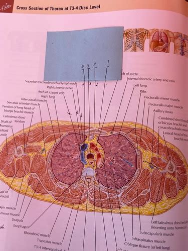 Cross Sectional Anatomy Flashcards Quizlet