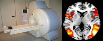 Functional Magnetic Resonance Imaging Fmri Agliotilab