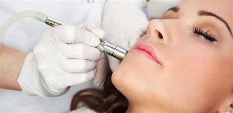 Qué es Dermapen y cómo puede ayudarte Nubel