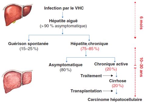 Virus de lhépatite C HCV AEMiP