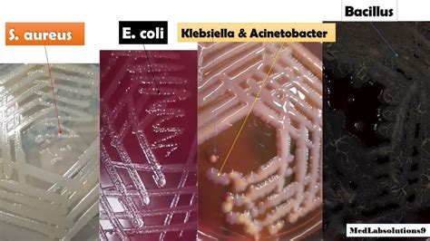 Most Common Bacterial Colony Morphology E Coli Klebsiella Pseudomonas