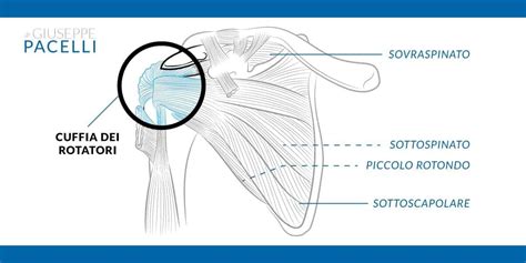 Cuffia Rotatori Anatomia Lesione Rottura Sintomi Diagnosi E Cure
