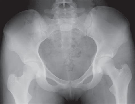 Female Pelvis Radiology Key