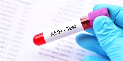 Adetin 3 günü yapılan hormon testleri nelerdir Soruyeri ile aradığın