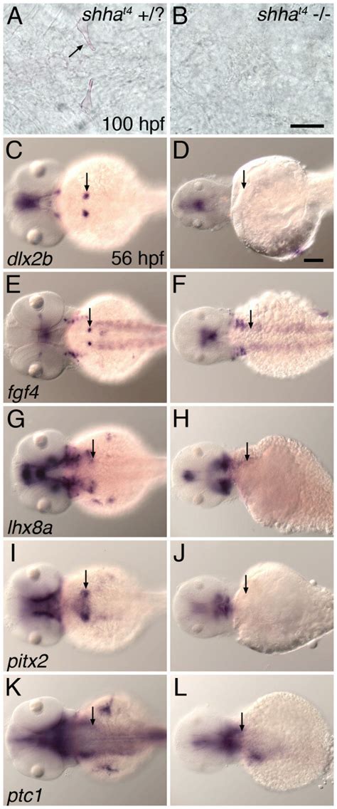 Zebrafish Mutant For Shha Do Not Exhibit Tooth Related Developmental