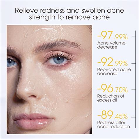 SKINEVER Salicylic Acid Acne Treatment Ice Sleep Masque And Refreshing