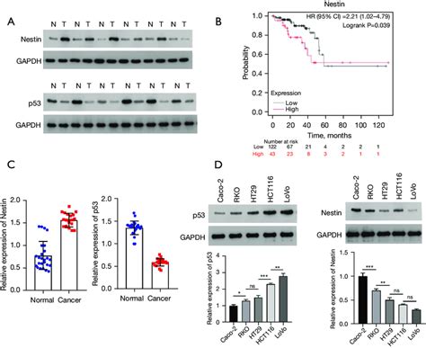 The Expression Of Nestin And P53 In CRC Tissues And Cells A The