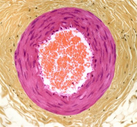 Arteriole Blood Vessel Light Micrograph Stock Image C019 8017