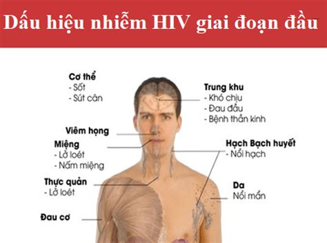 15 Dấu hiệu HIV sớm nhất Nhận biết nhiễm sida qua hình ảnh