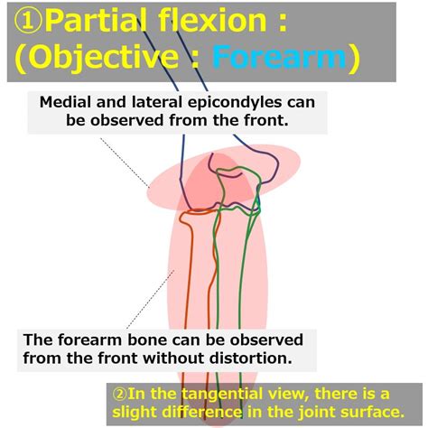 Elbow Ap View Alternate Partial Flexion Tangential View Tools For