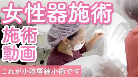 小陰唇縮小術施術解説動画大公開女性器のお悩み解消デリケートゾーンの施術VIO整形 YouTube