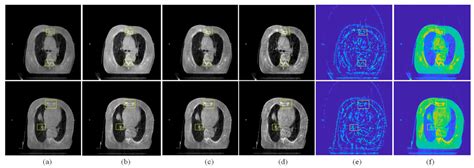 applied sciences free full text adaptive visual saliency feature enhancement of cbct for