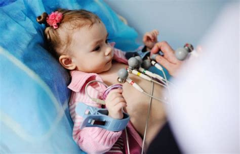 Eletrocardiograma infantil o que é e para que serve o ECG pediátrico