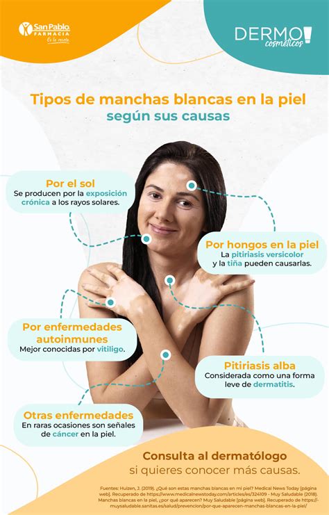 Como Quitar Las Manchas Blanca De La Cara On Sale Dakora Co