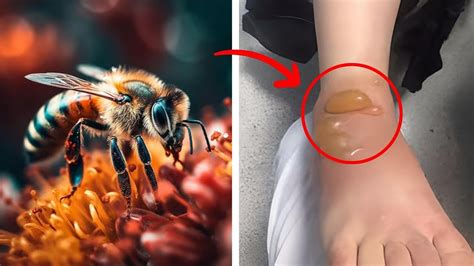LOS 10 INSECTOS MAS PELIGROS DEL MUNDO TEN CUIDADO YouTube