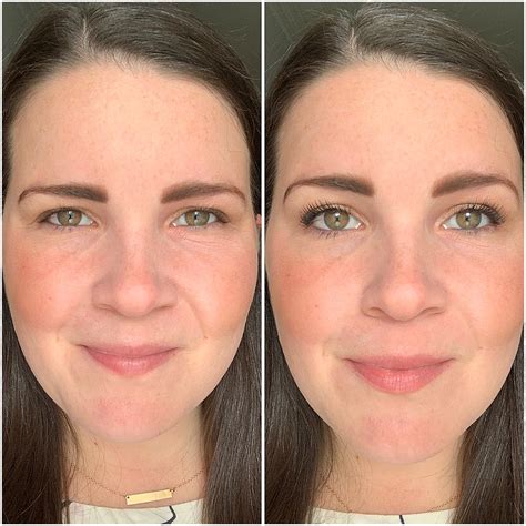 Albums Pictures Therma Lift Before And After Pictures Latest