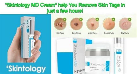 Skintology Md Skin Tag Removal Reviews Skintology Shark Tank On