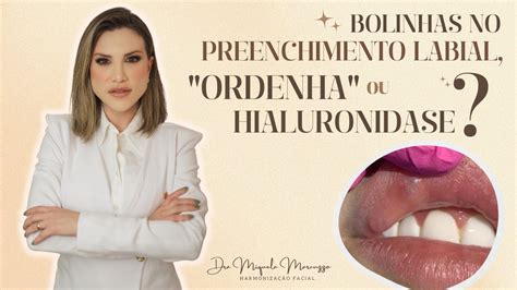BOLINHAS NO PREENCHIMENTO LABIAL O QUE FAZER YouTube