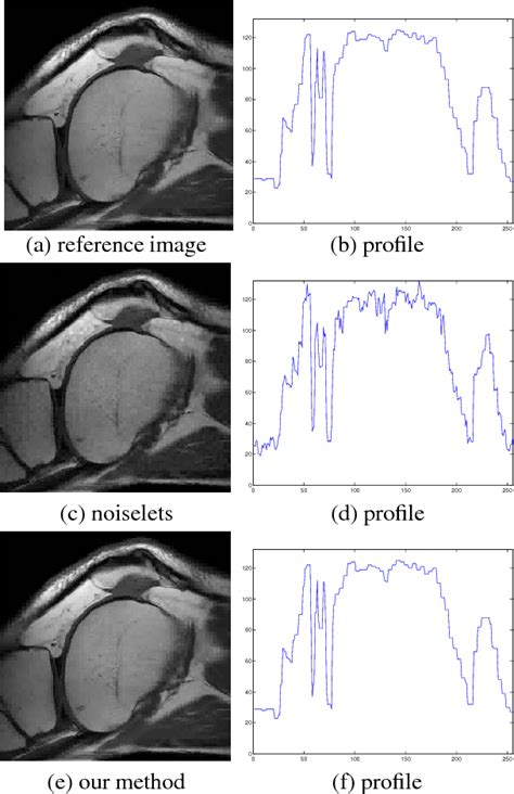 figure 2 from using reed muller sequences as deterministic compressed sensing matrices for image