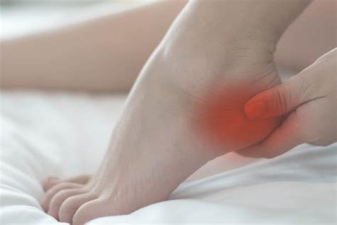 Espolón calcáneo Qué es causas síntomas y tratamiento Fisio For
