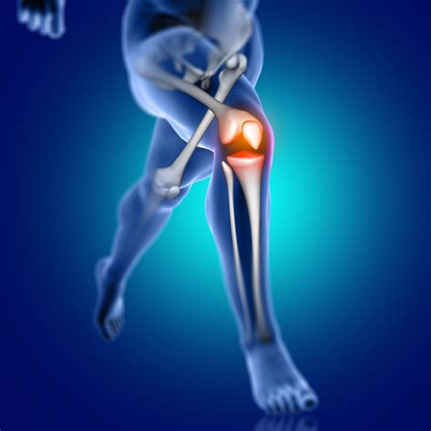 Anterior Cruciate Ligament Acl Injuries Physio Health
