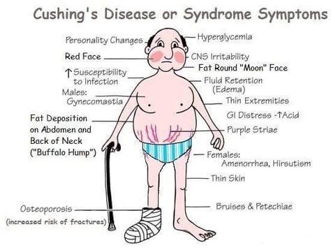 Cushing Disease With Images Cushings Syndrome Cushing Disease