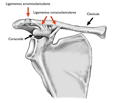 Tratamento Para Luxa O Acromioclavicular Em Sp