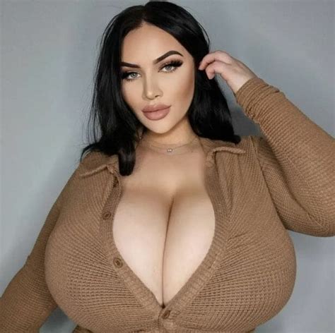 مرض نادر يجعل ثديي عارضة أزياء ينموان أربعة أضعاف حجمهما الطبيعي كل عام