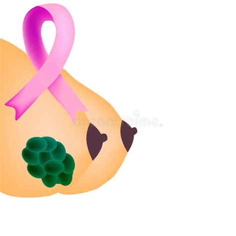 D A Mundial Del C Ncer De Mama Cinta Rosa Contra El C Ncer De Mama