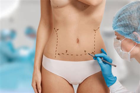 Cirurgias plásticas mais realizadas no Brasil em 2023 Minha Cirurgia