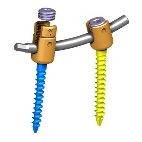 Sistema de fijación de columna posterior GS BIO Implantes
