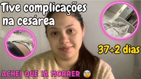 MEU RELATO DE PARTO CESÁREA PELO SUS 37 SEMANAS 2 DIAS TIVE