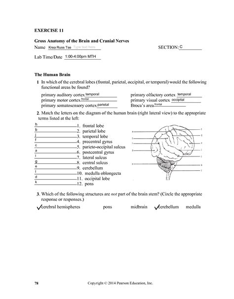 Solution Gross Anatomy Brain And Cranial Nerves Worksheet Studypool