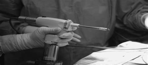 Minced Articular CartilageBasic Science Surgical Technique