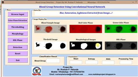 Detection Of Blood Group Type Using Machine Learning YouTube