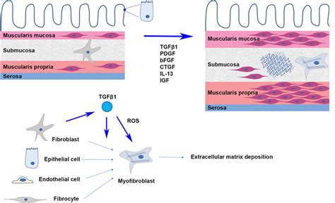 Frontiers Crohns StricturesMoving Away From The Knife