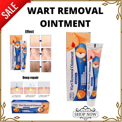 Effective Warts Removal Ointment Wart Remover Warts Remover