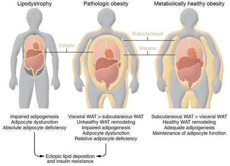 Jci Contribution Of Adipogenesis To Healthy Adipose Tissue Expansion In Obesity