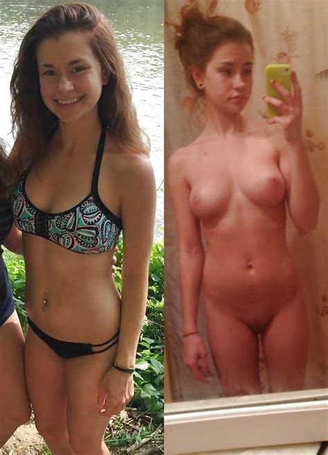 Prima E Dopo L Aumento Del Seno Categorie Fotografiche Porno