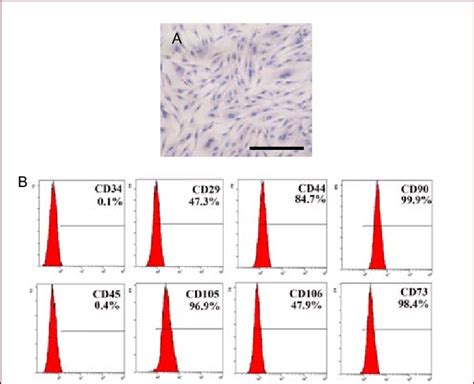 Morphology And Immunophenotype Of Umbilical Cord Derived Cells At
