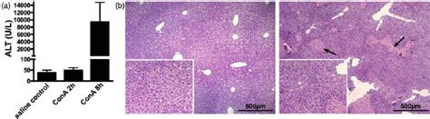 Liver Damage After Concanavalin A ConA Mediated Liver Damage A