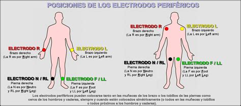 Colocación de electrodos ECG