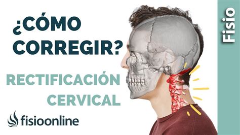 Rutina de ejercicios para la rectificación cervical FisioOnline