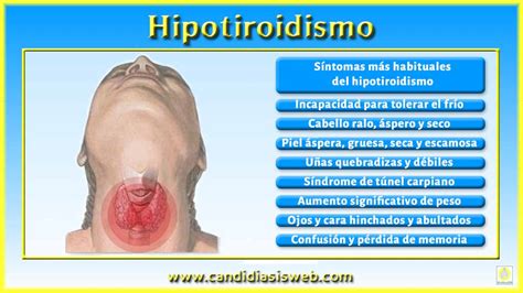Síntomas de la candidiasis Hipotiroidismo