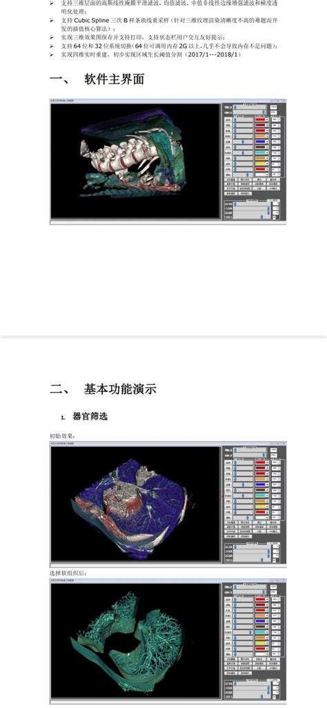 vtk三维重建系统 系统开发案例 程序员客栈